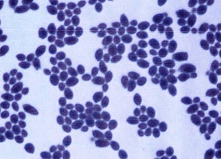 Micro lab comments: candidaemia and candiduria | AIMED - Let's talk ...